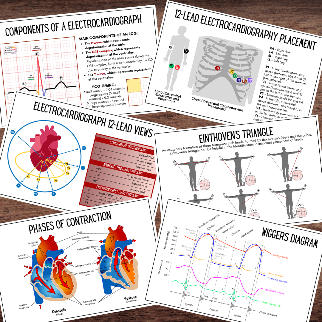 Cardiac ECG Study: Cardiac Cycle Spinner, Rhythm Strip Matching, Flash ...