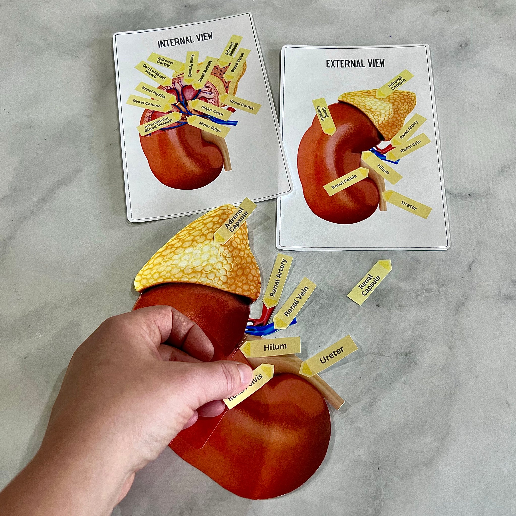 Anatomy HUMAN KIDNEY - Full Color Anatomically Correct 2D Dissection A ...