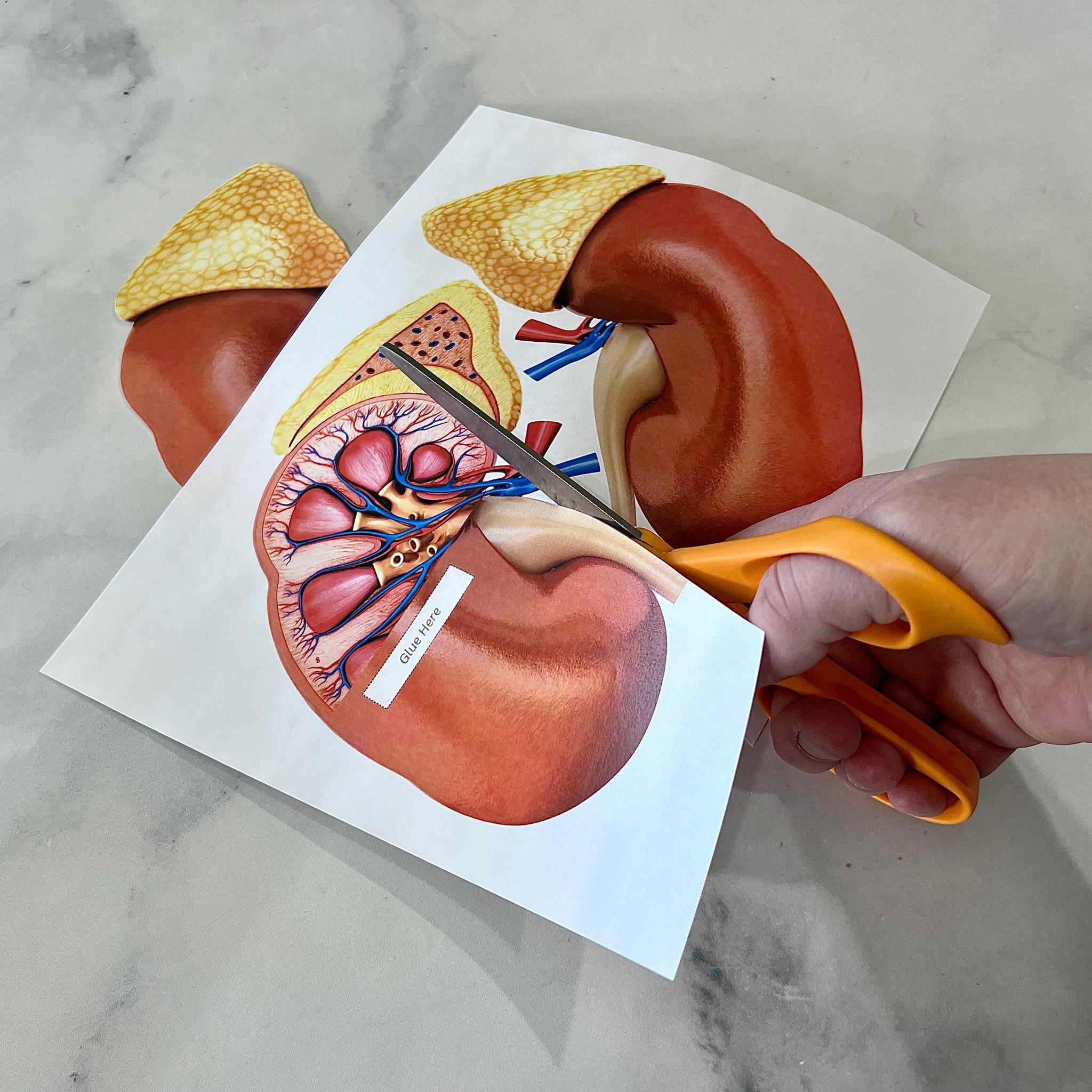 Anatomy HUMAN KIDNEY - Full Color Anatomically Correct 2D Dissection A ...