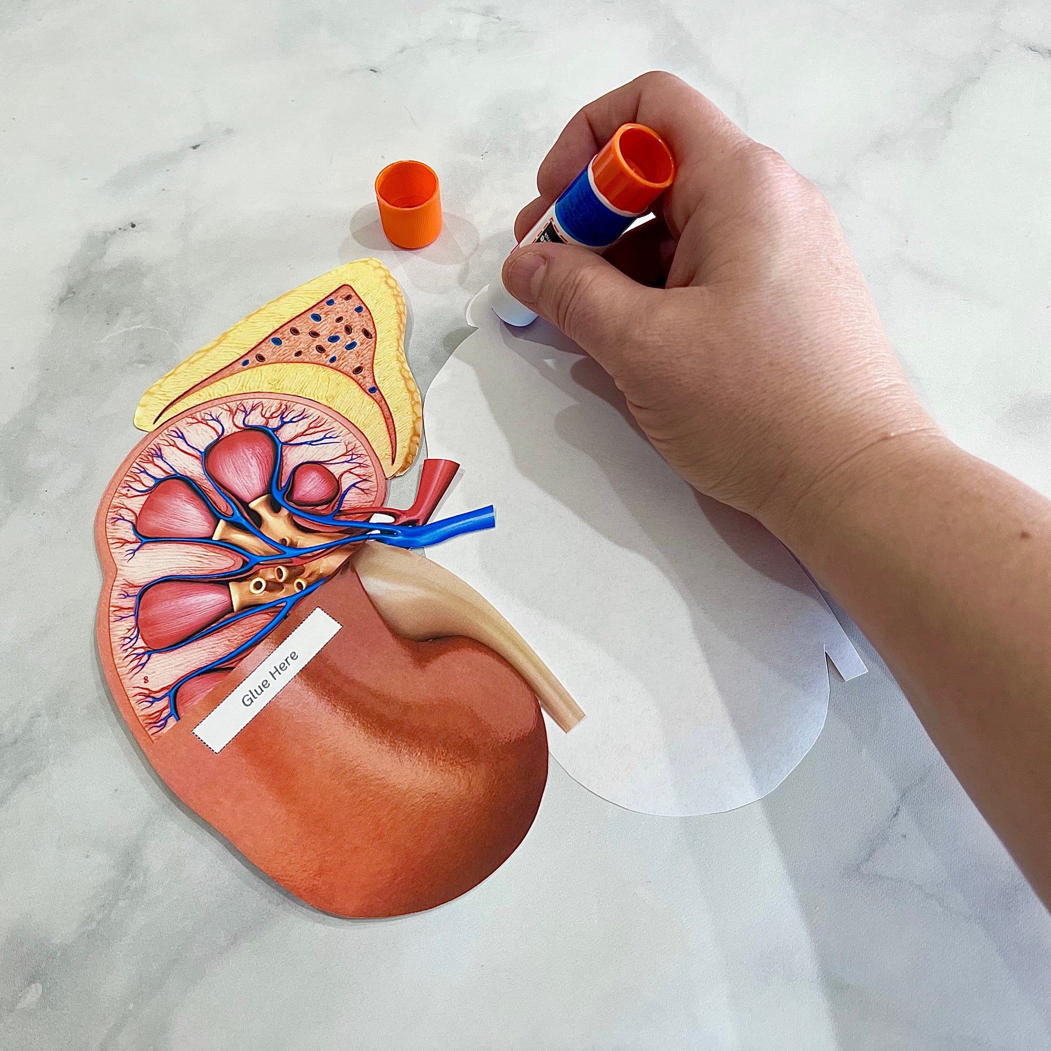 Anatomy HUMAN KIDNEY - Full Color Anatomically Correct 2D Dissection A ...